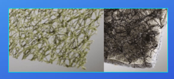 Enkamat/Enkadrain Products| Enkamat Distributors